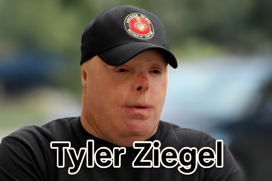 Tyler Ziegel: A Powerful Journey of Courage, Sacrifice, and Unbreakable ...